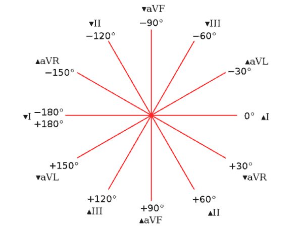 12 Lead EKG Interpretation Parameters - Allied Medical Training